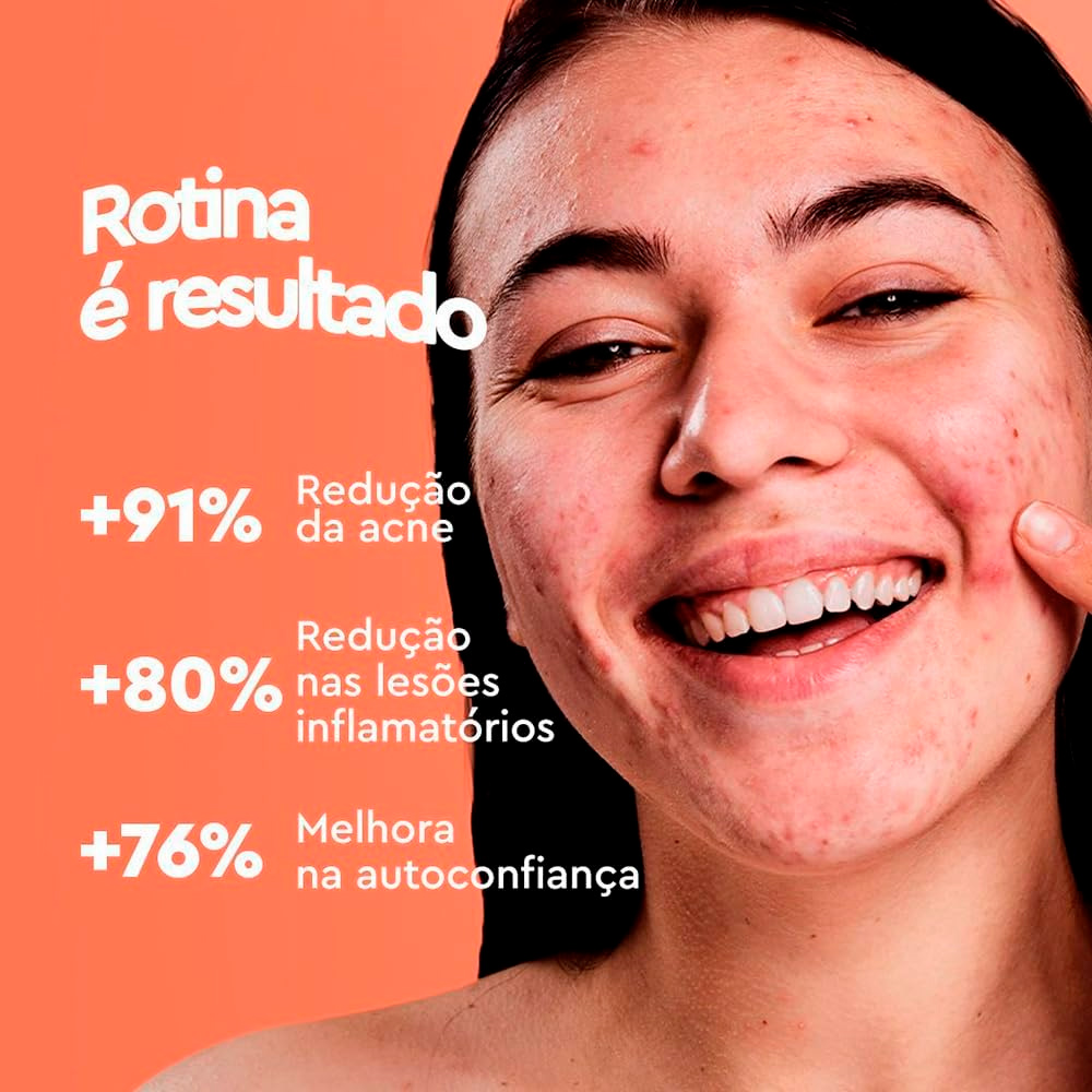 Kit 2 Pomada para Espinhas Rosto Gel Secativo Antiacne Acnezil 10g ...
